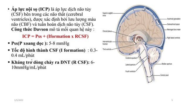 Elevated intracranial pressure (icp) in children | PPT