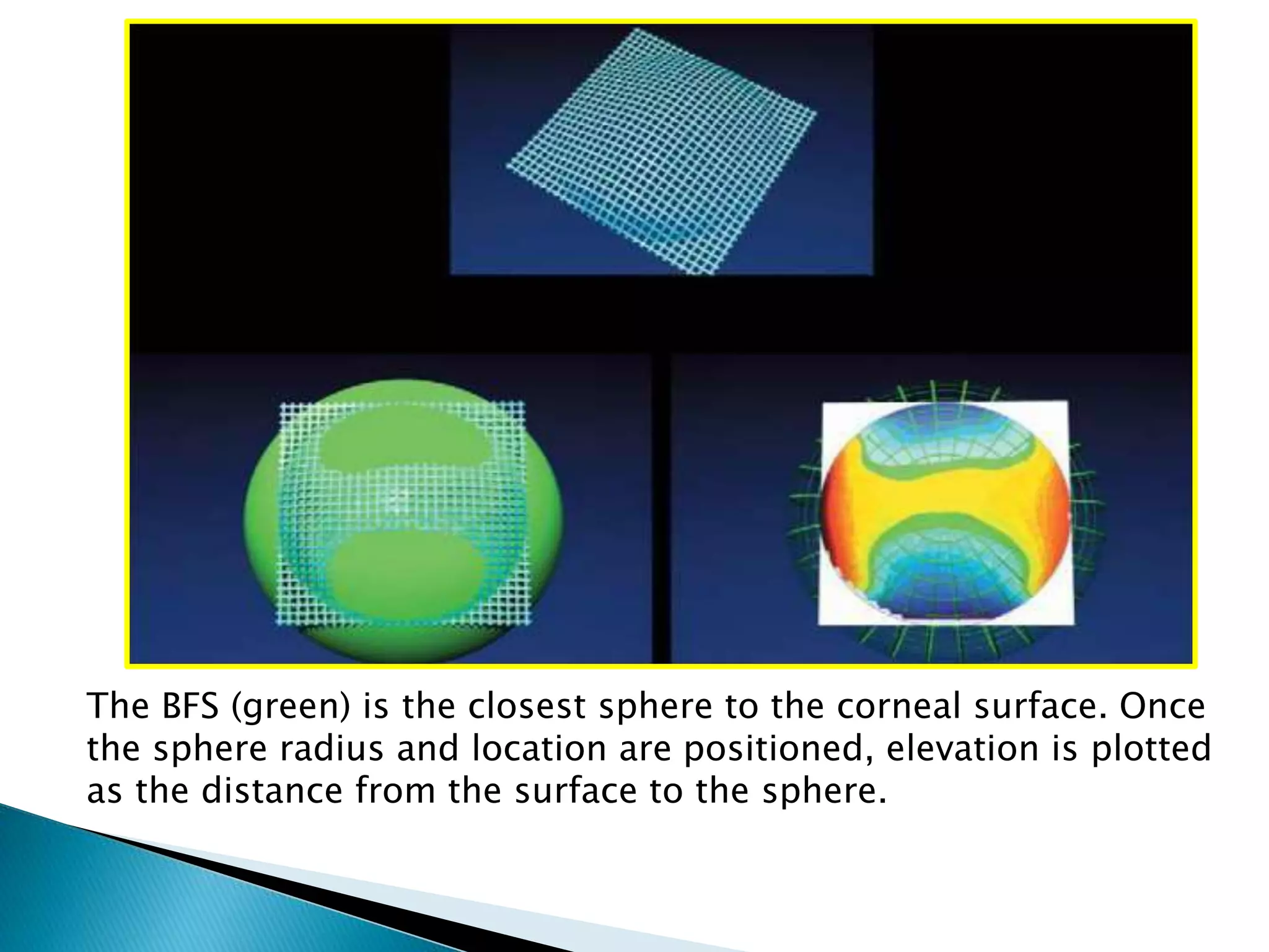 ELEVATION BASED CORNEAL TOPOGRAPHY.pptx