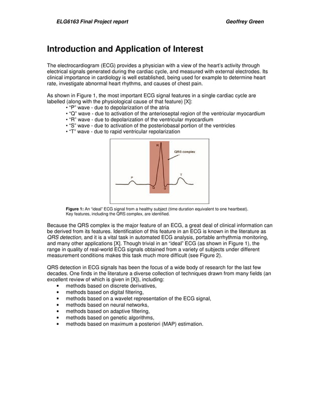 QRS signal ECG detection | PDF | Computer Software and Applications ...