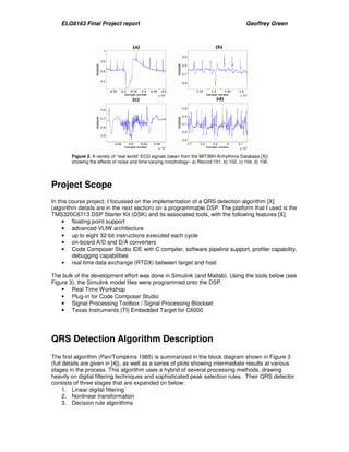 QRS signal ECG detection | PDF | Computer Software and Applications | Computing