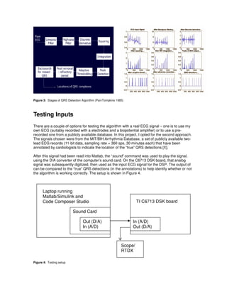 QRS signal ECG detection | PDF | Computer Software and Applications | Computing