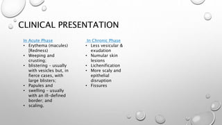 ECZEMA - dermatology case presentation | PPTX