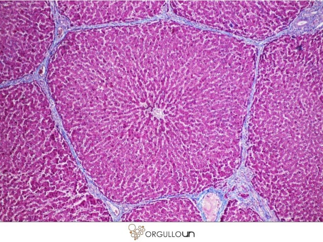 El Hígado - Morfología, Histología y Fisiología