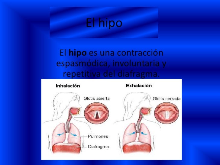 El hipo.