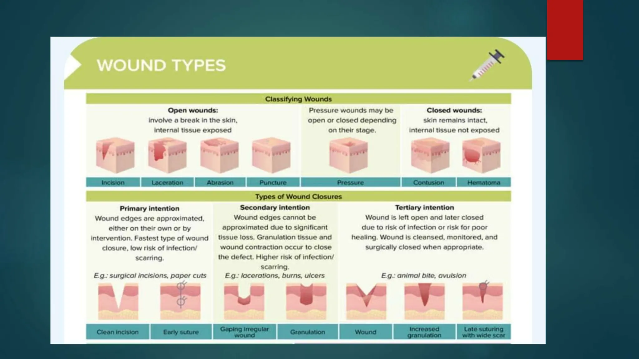 Elicit, Document and present history in a patient presenting with wounds..pptx