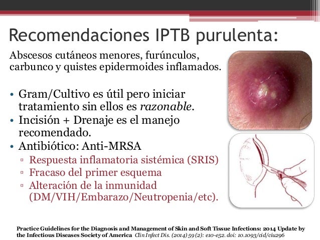 Eligiendo la mejor opción en antibióticos en infección de piel y teji…