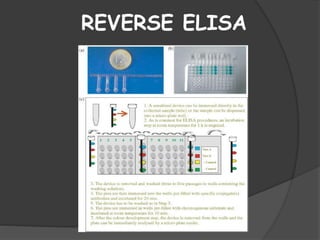 Elisa | PPTX