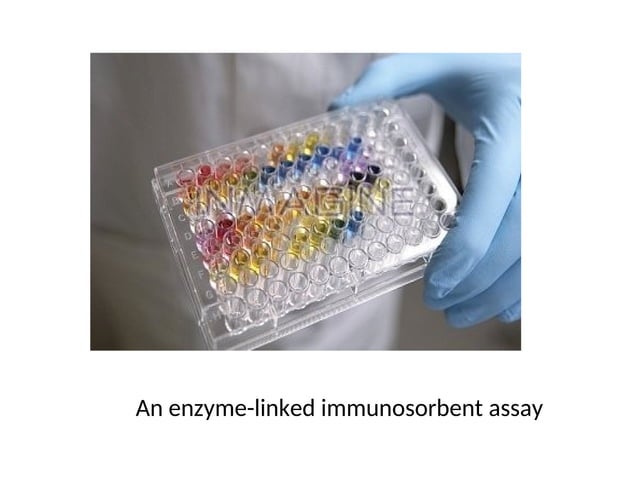 kuliah elisa (enzyme linked immunosorbent assay).ppt