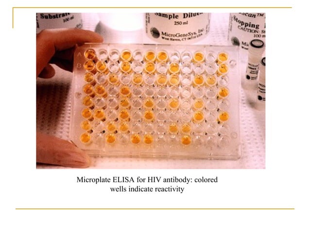 Enzyme linked immunosorbent assay techniques | PPT