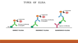 Elisa pptx | PPT