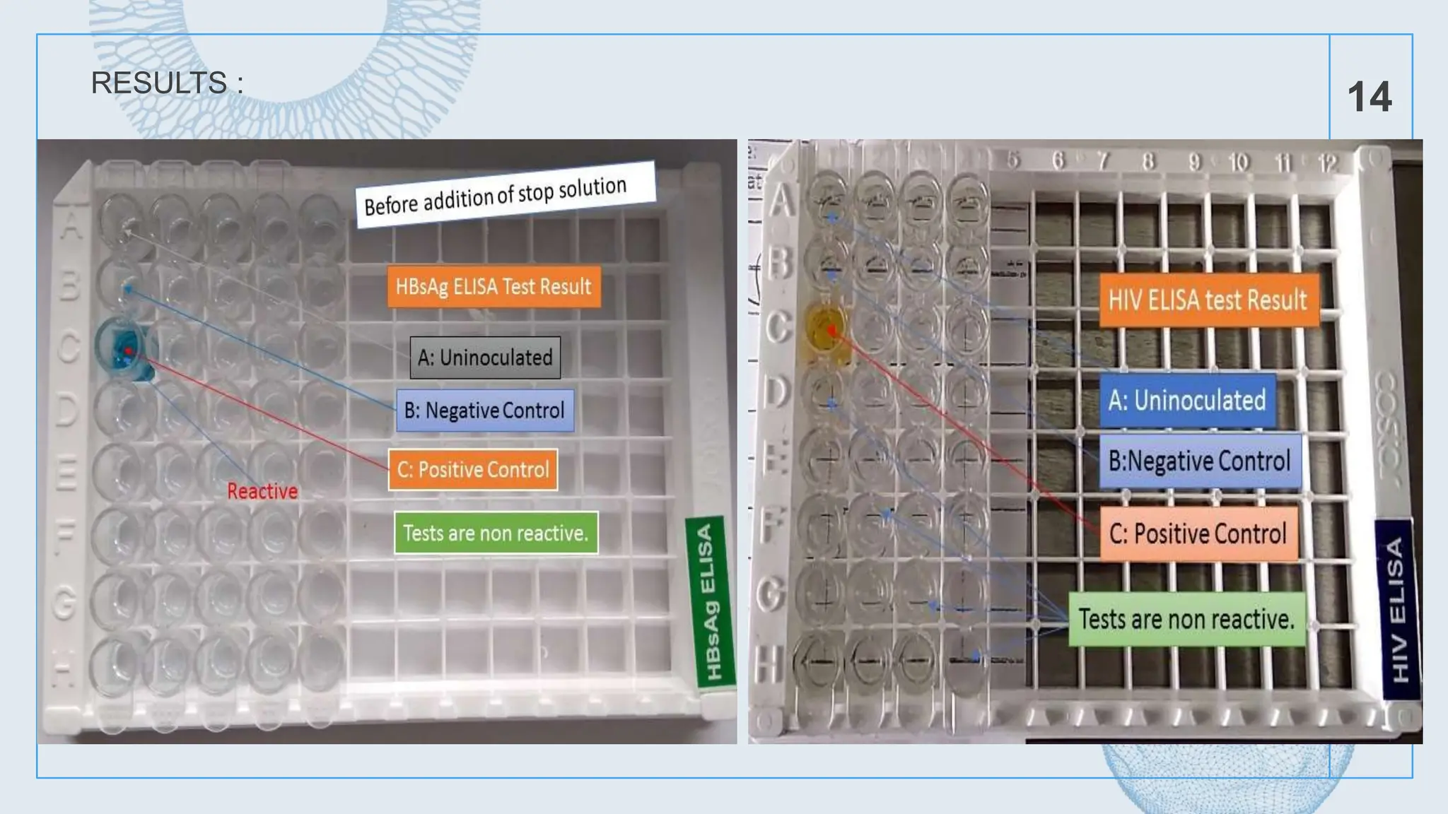 elisa model based on laboratory technique .pptx