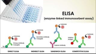 EbbbbbbbbbbbbbbbbbbbbbbbbbbbbLISA_IRA-62909435[2].pptx