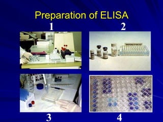 ELISA & PCR.ppt