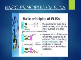 Elisa technique | PPT