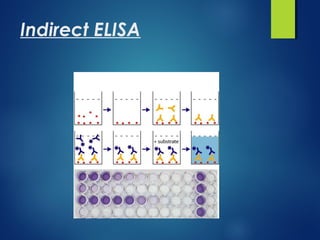 Elisa technique | PPT