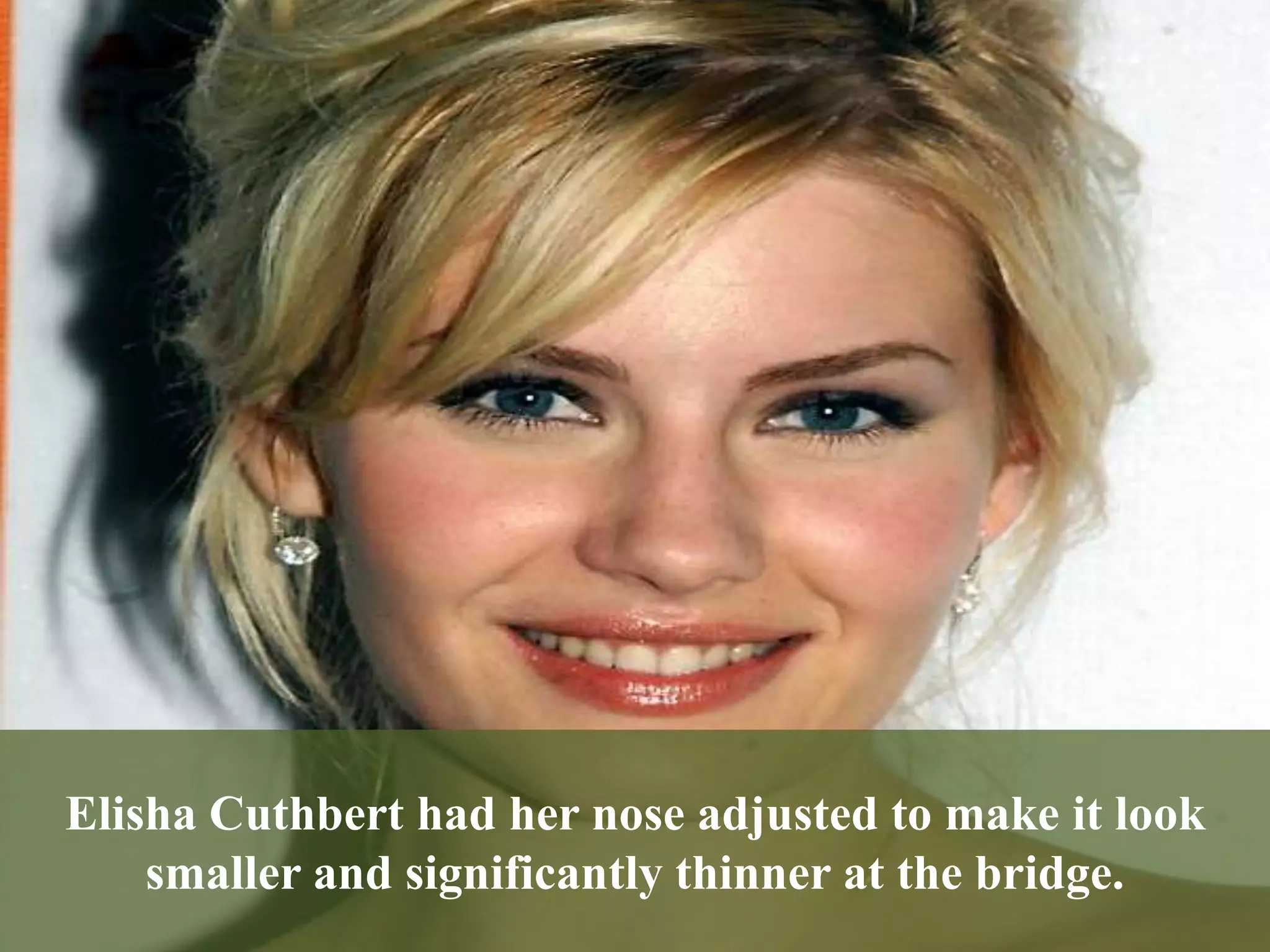 Elisha cuthbert plastic surgery | PPTX