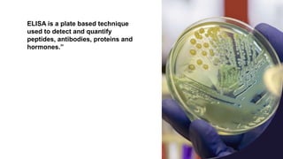 ENZYME LINKED IMMUNOSORBENT ASSAY (ELISA) | PDF