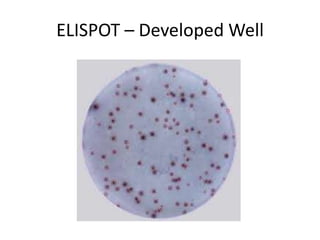 ELISA Vs ELISPOT - Principle, Procedure, Advantages | PPTX
