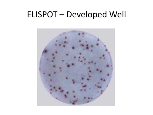 ELISA Vs ELISPOT - Principle, Procedure, Advantages | PPTX