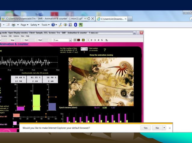 Elizabeth McCrann neurofeedback for adhd | PPTX