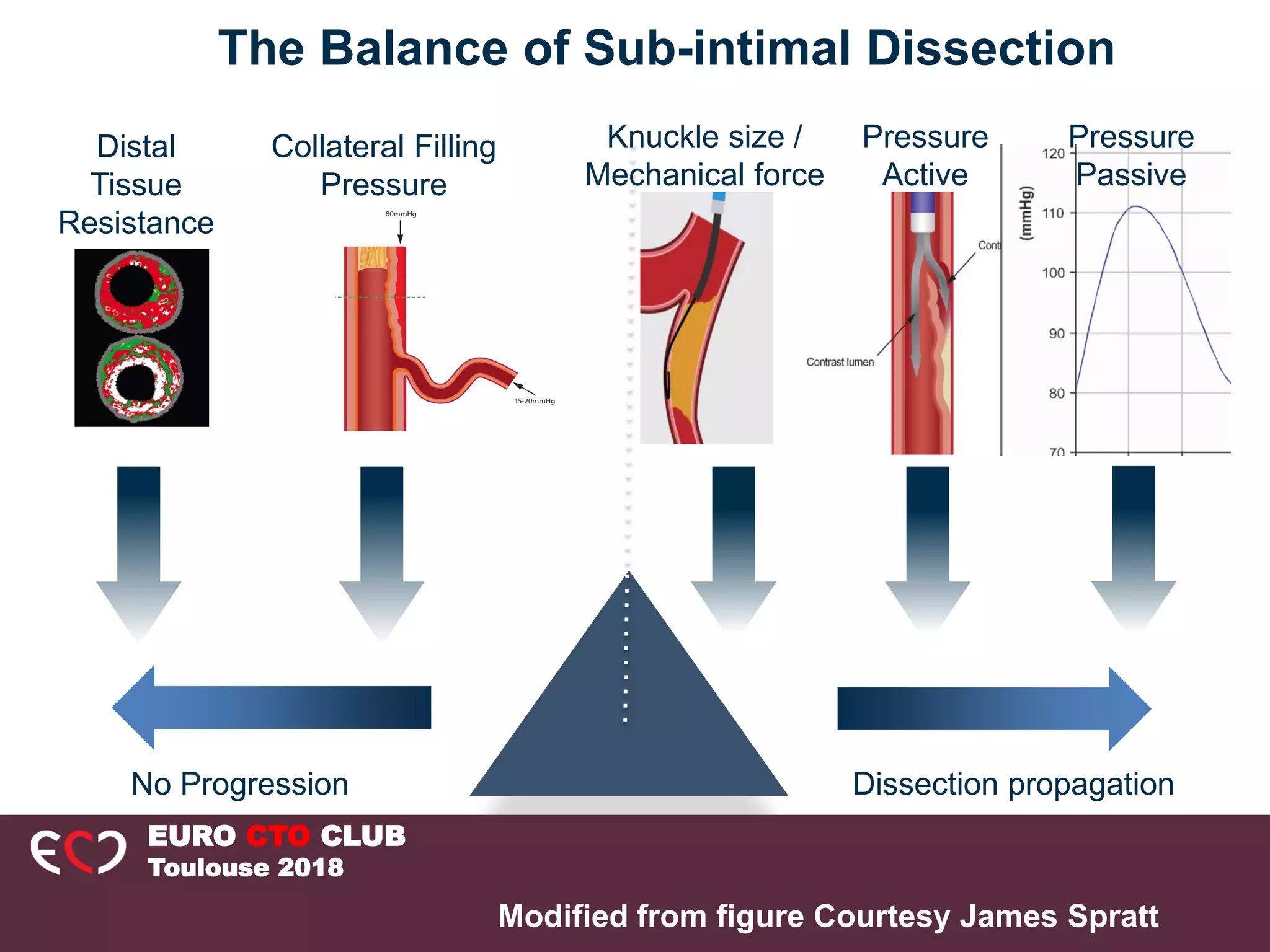 Antegrade dissection and haematoma | PDF