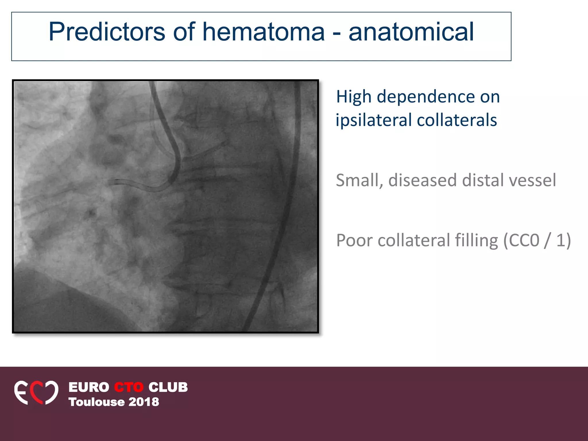 Antegrade dissection and haematoma | PPT