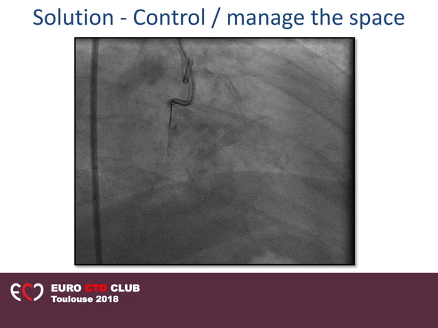 Antegrade dissection and haematoma | PPT