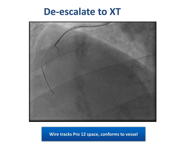 Antegrade dissection and haematoma | PPT