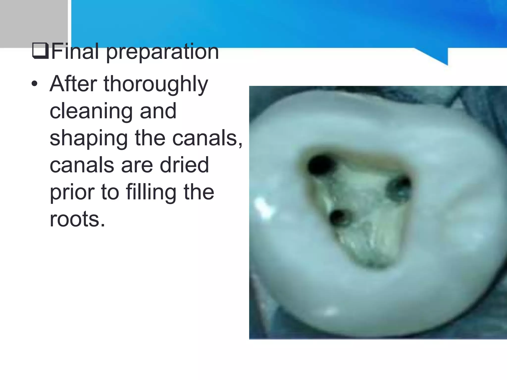 Management of Ellis Class IV Fracture | PPTX