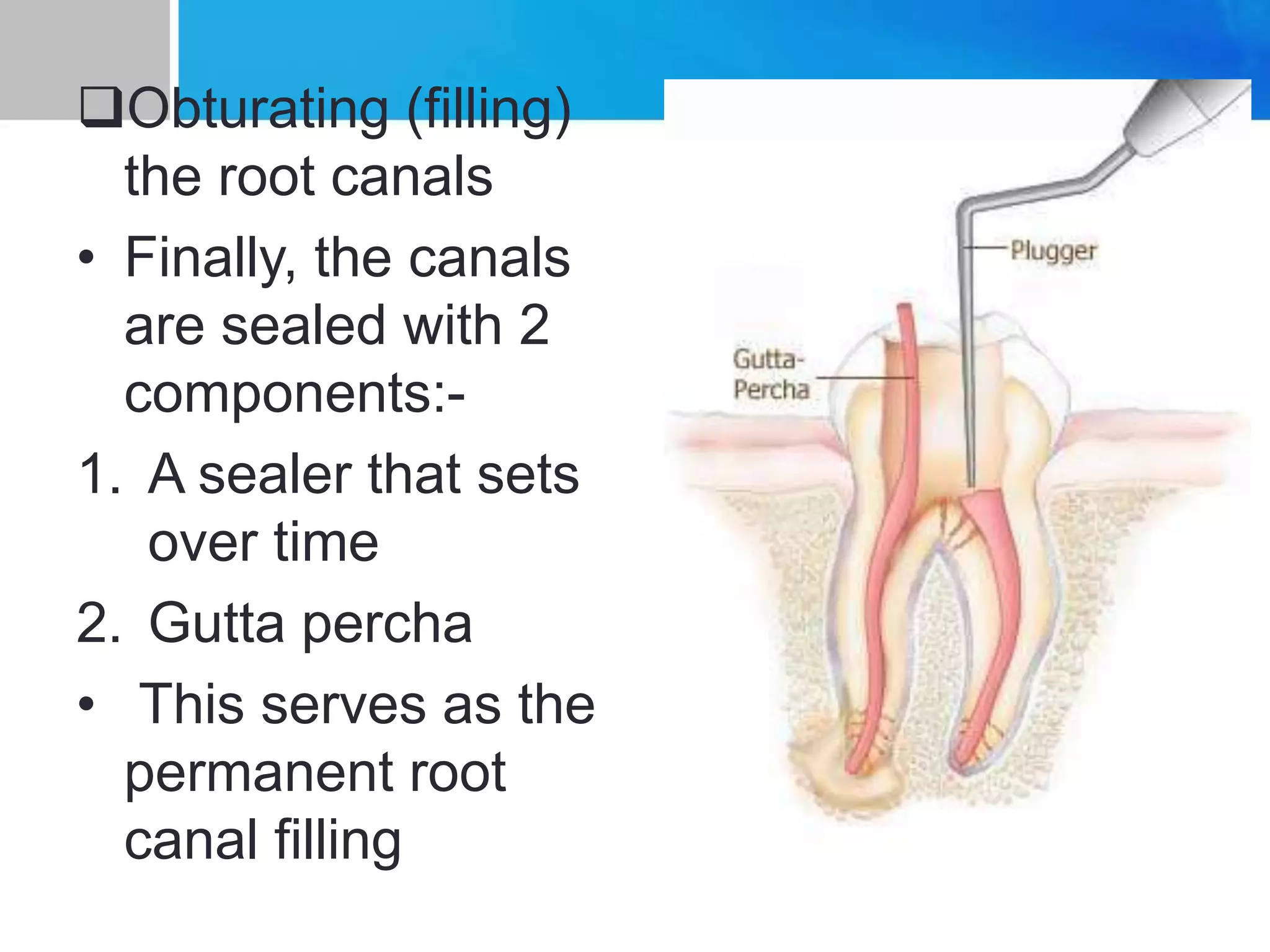 Management of Ellis Class IV Fracture | PPTX