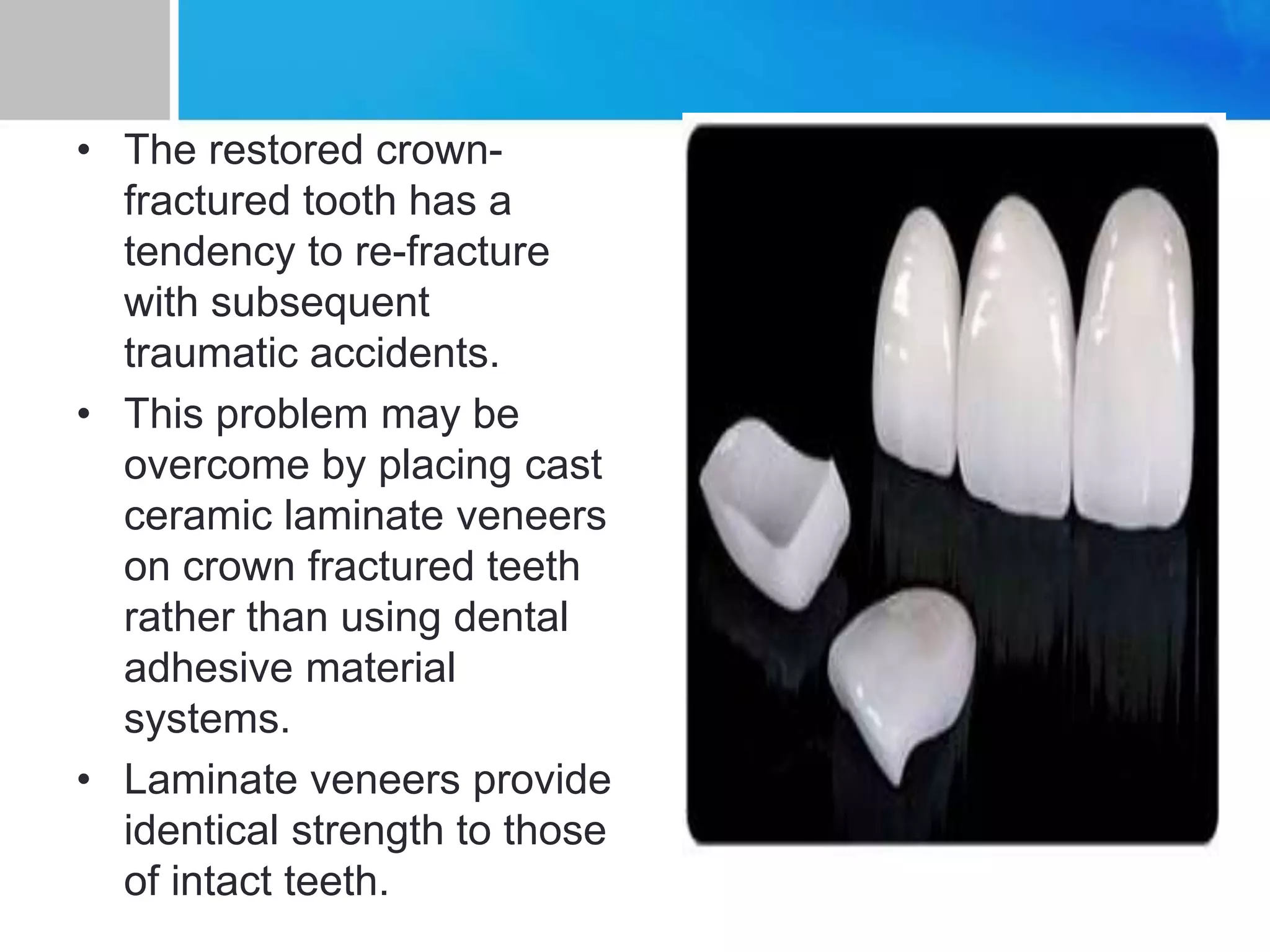 Management of Ellis Class IV Fracture | PPTX