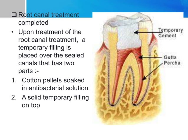 Management of Ellis Class IV Fracture | PPTX | Dental Health | Diseases ...