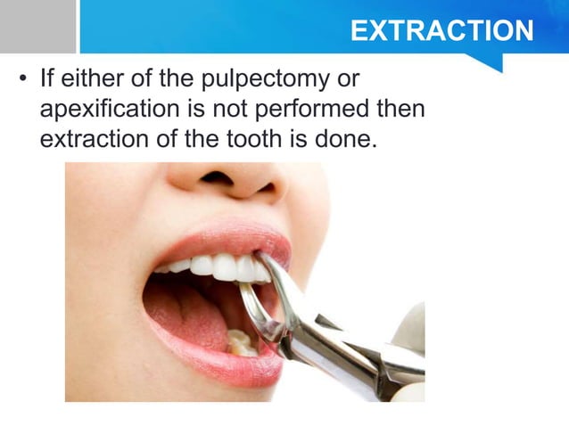Management of Ellis Class IV Fracture | PPTX | Dental Health | Diseases ...