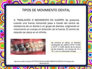 El manejo de las fuerzas biomecanicas en ortodoncia | PPT