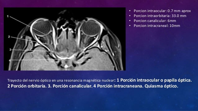 El nervio óptico y su patología.