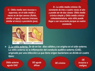 El oido profesor crisologo | PPTX