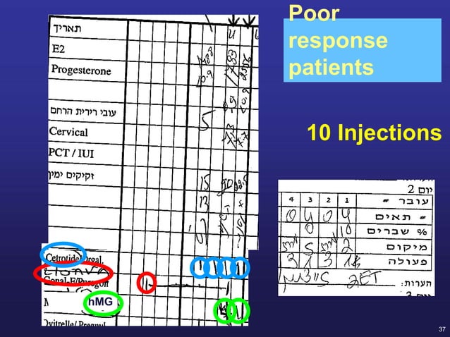 Elonva: A new patient friendly approach in ART | PPTX