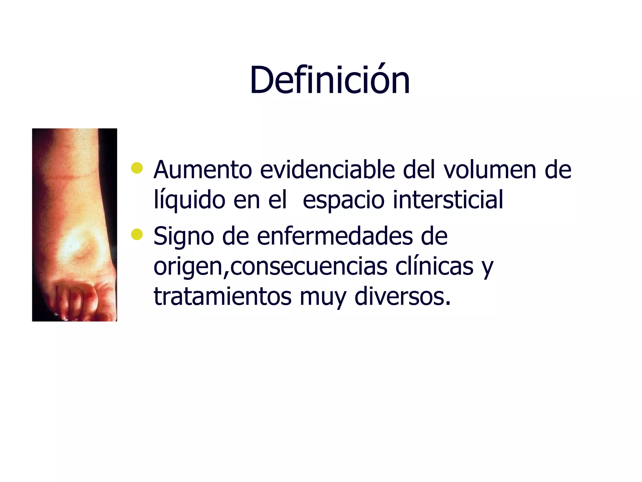 El paciente con edema | PPT