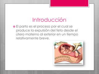 El parto | PPTX