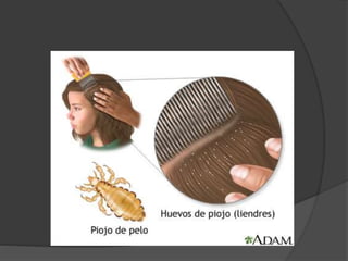 El piojo | PPTX