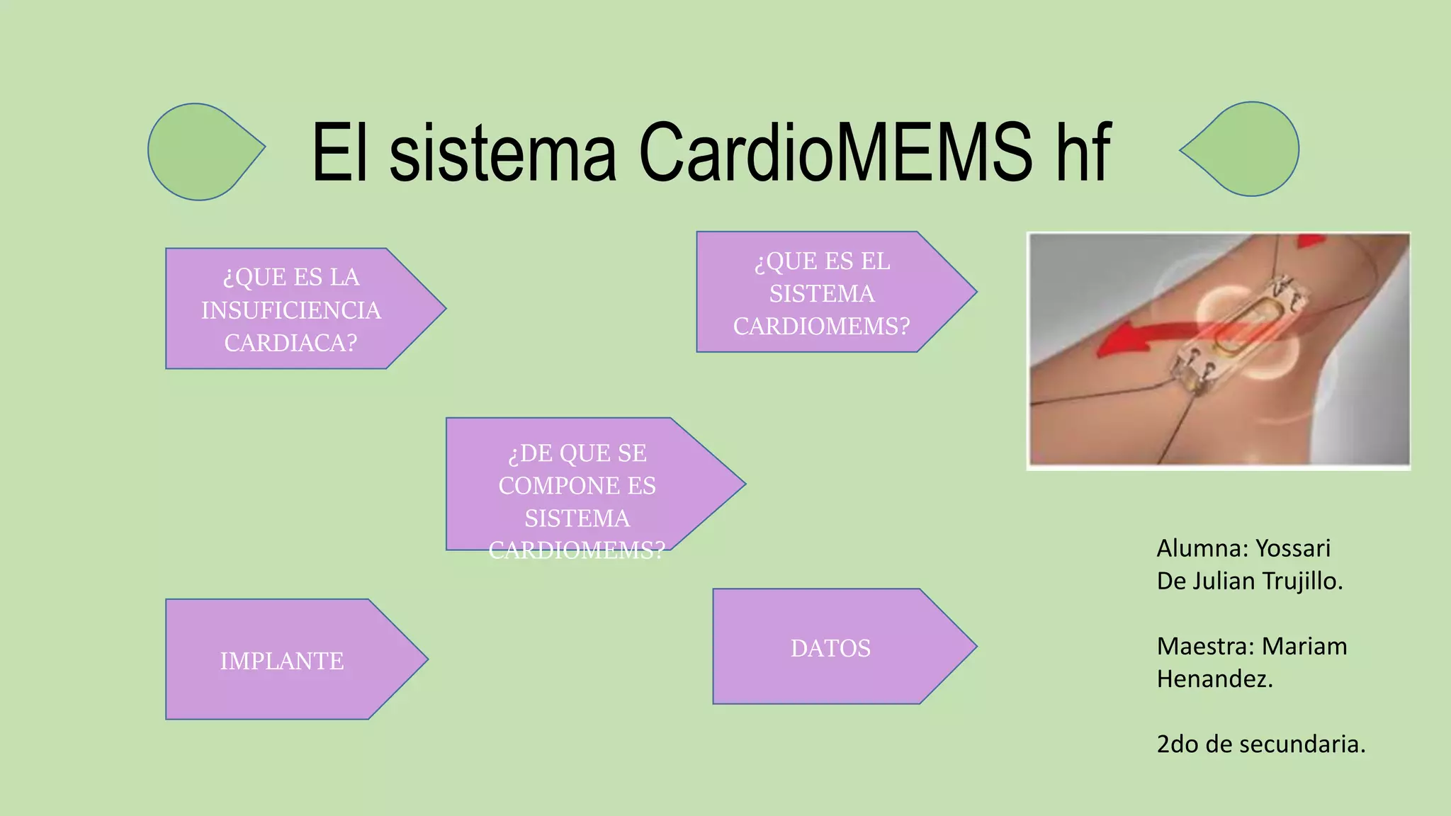 El sistema CardioMEMS.pptx