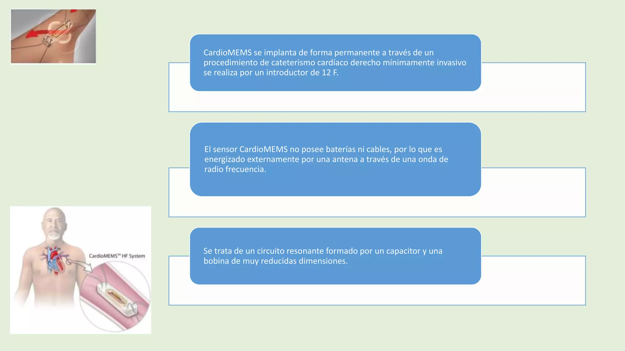 El sistema CardioMEMS.pptx