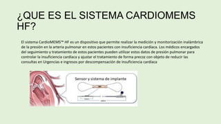 El sistema CardioMEMS.pptx