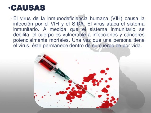 Vih O Sida: Qué Es, Causas, Síntomas Y Tratamiento – TSQK