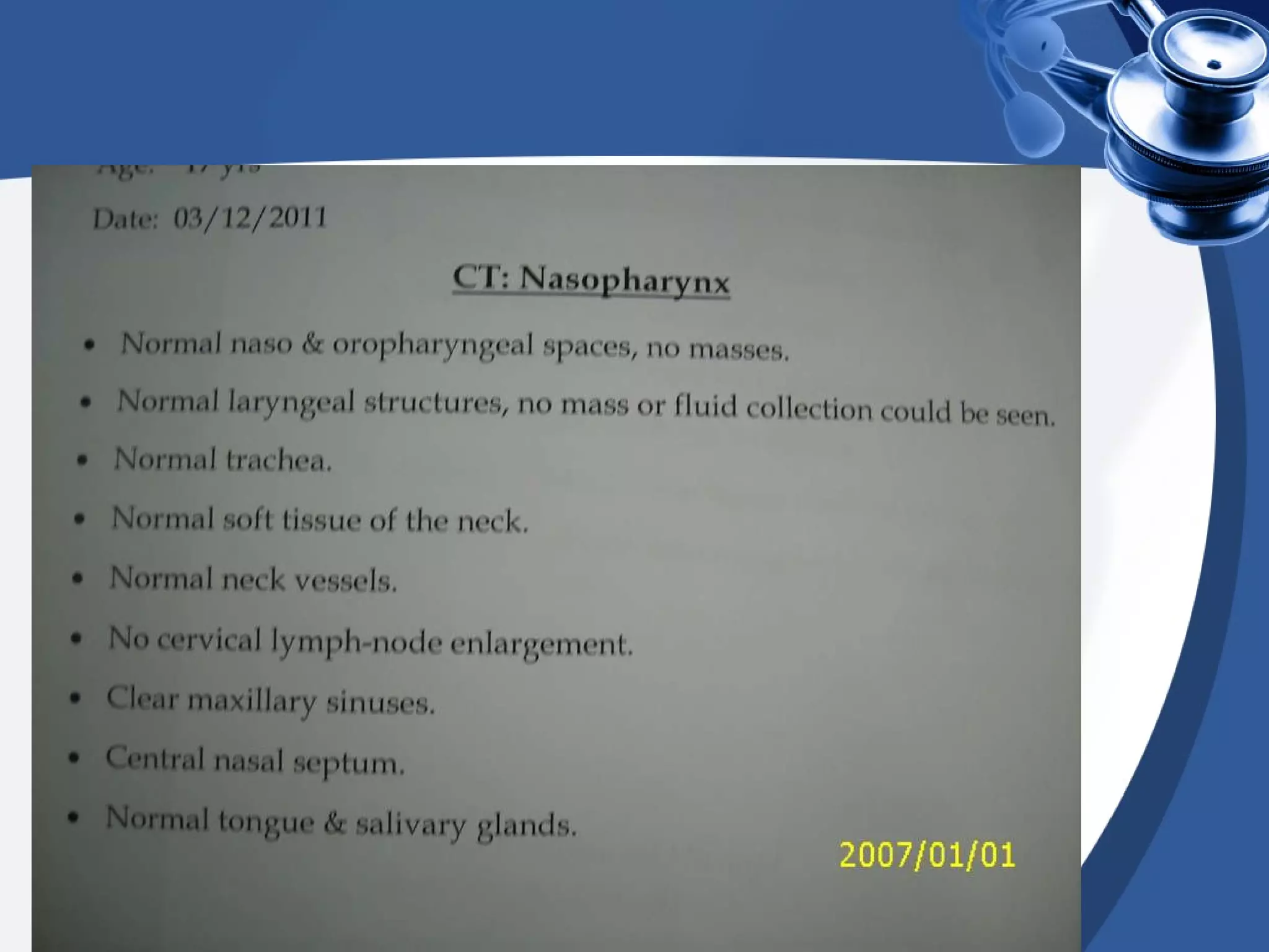 GBS case presentation | PPT