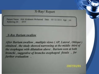 GBS case presentation | PPT