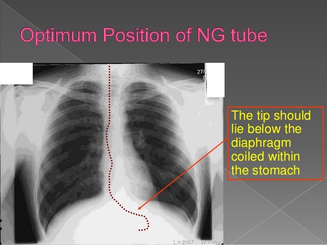 chest radiology in ICU
