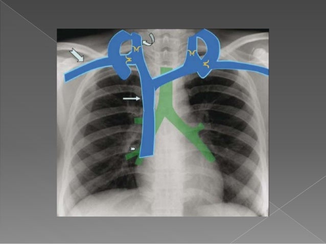 chest radiology in ICU