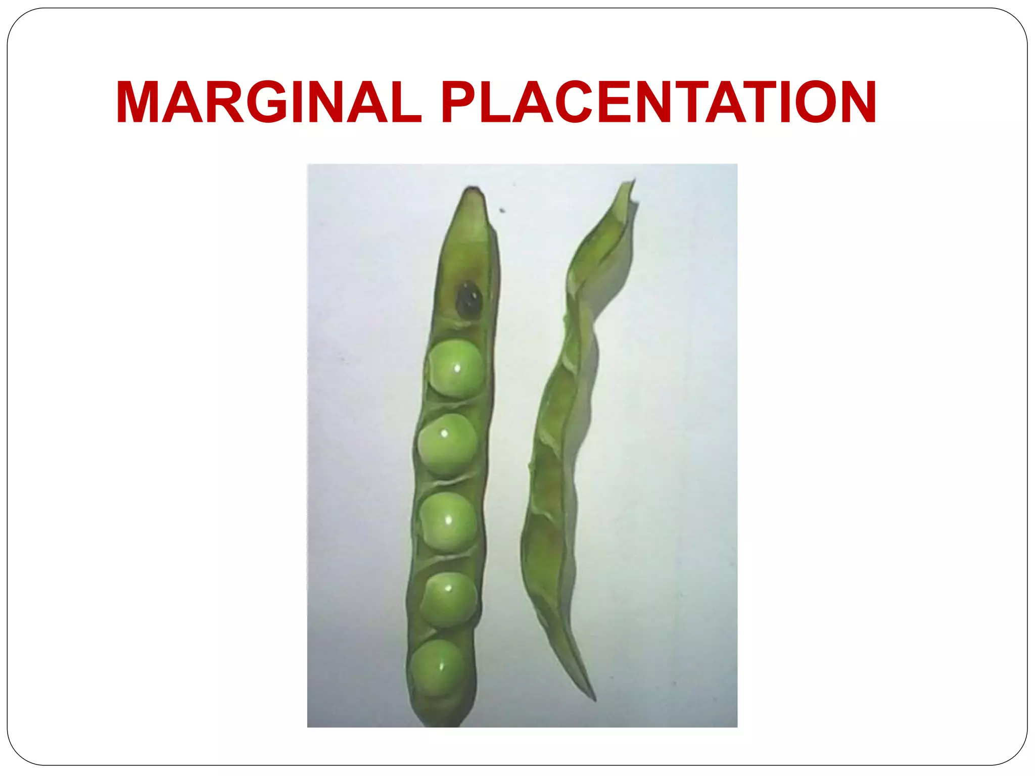 Emasculation in red gram | PPTX