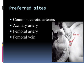 Embalming all points | PPT